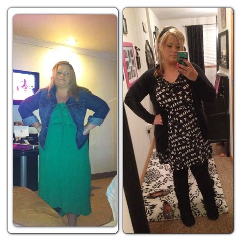 Erikas Lap Band To Sleeve Revision Before And After Photos And Story