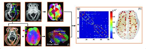 Flow Chart Demonstrating The Data Analysis Process To Quantify