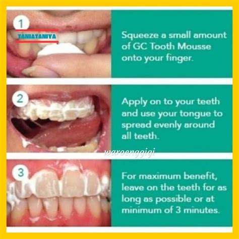 Jual Gc Plus Gc Tooth Mousse Plus Gc Toothmousse Taniataniya