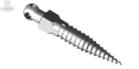 Microimplants In Orthodontics