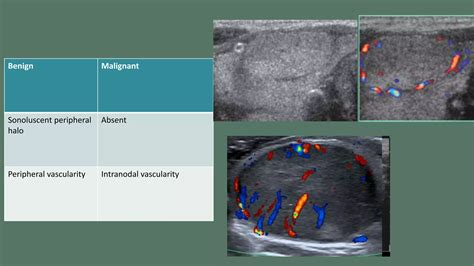 Imaging Of Thyroid Pptx