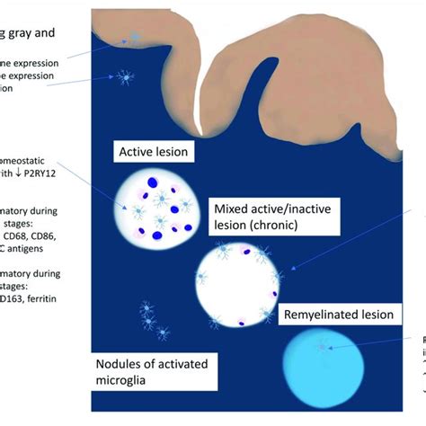Role Of Microgila In Ms Pathology Download Scientific Diagram