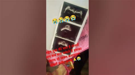 आप सब जरूर इस वीडियो को देखिए और कमेंट में बताइए😭😭 Youtube