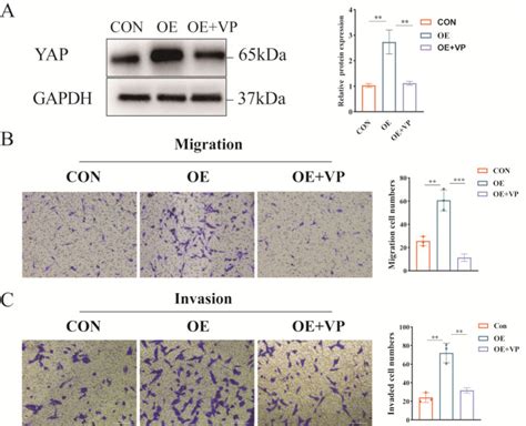 Circ 0002970 Promotes Fibroblast Like Synoviocytes Invasion And The