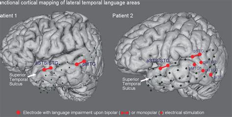 Figure 1 From Left Anterior Temporal Cortex Actively Engages In Speech