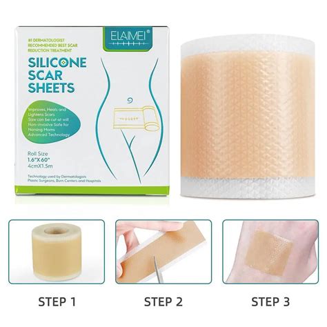 Parche De Silicona Para Tratamiento De Cicatrices 150cm Cinta Para