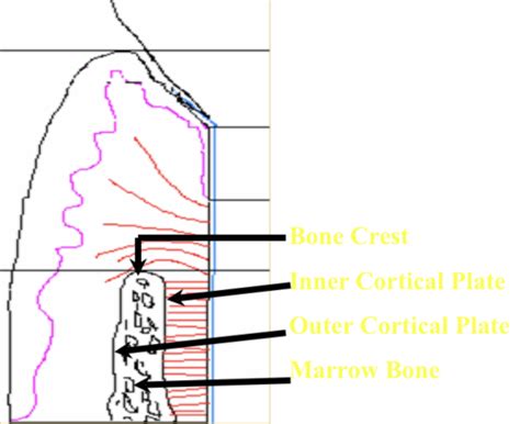 Alveolar Bone Jan 2 Flashcards Quizlet