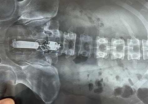 Hú Hồn Trai Việt Kẹt đồ Chơi Tình Dục Trong Vùng Kín Thế Giới đàn ông
