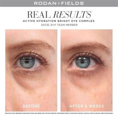 Active Hydration Bright Eye Complex Puffy Eyes Eye Cream For Dark