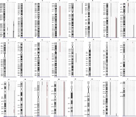 Chromosomal Ideograms Of Genomic Alterations Detected By Array CGH