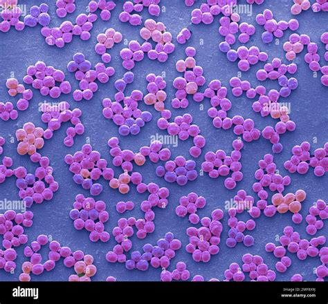 Group A Streptococcus Bacteria SEM Stock Photo Alamy
