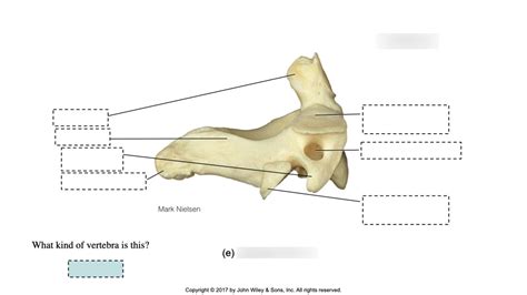 Diagram Of Right Lateral View Of C Axis Quizlet