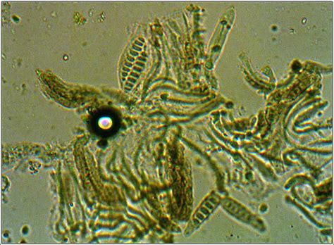 Lichen Graphis Scripta Sens Lat