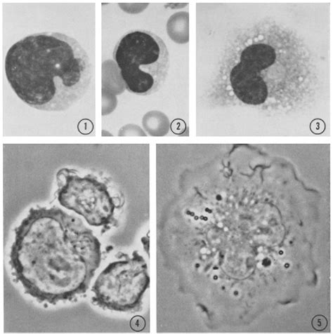 Promonocyte Count Semantic Scholar