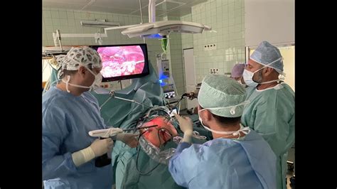 Denis Kravtsov On Linkedin Laparoscopic Proximal Gastrectomy With Double Tract Reconstruction In A…