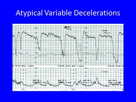 Ctg Interpretation And Management Ppt Video Online Download