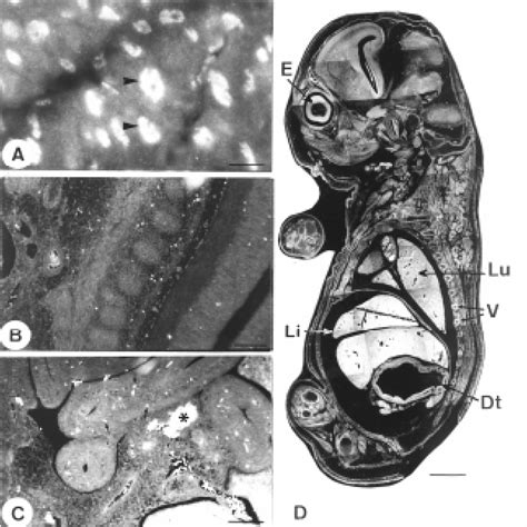 Developmental Expression Of Ppar βδ In The Mouse Embryo The
