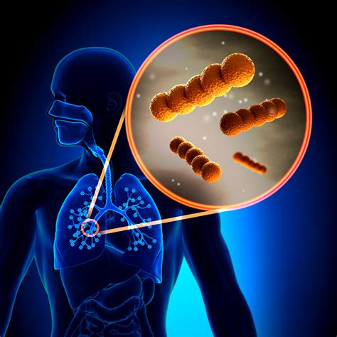 Pseudomonas Aeruginosa Lung Infection