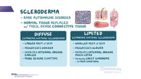Skin Signs Of Scleroderma A Dermatological Approach To Diagnosis And Treatement Ppt