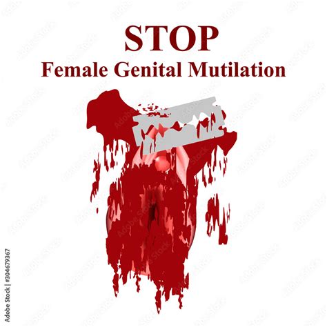 International Day Of Zero Tolerance For Female Genital Mutilation