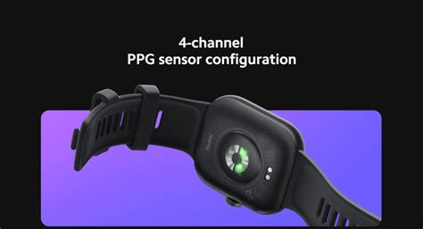 Redmi Watch Price In Pakistan Xcessorieshub