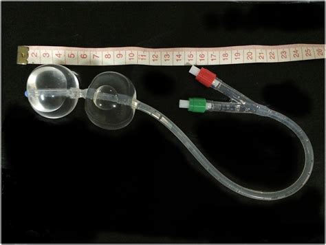 Balloon Catheter Induction Australia Free