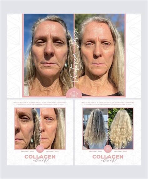 Isagenix Collagen Elixir Review Before And After Photos 2024a Less