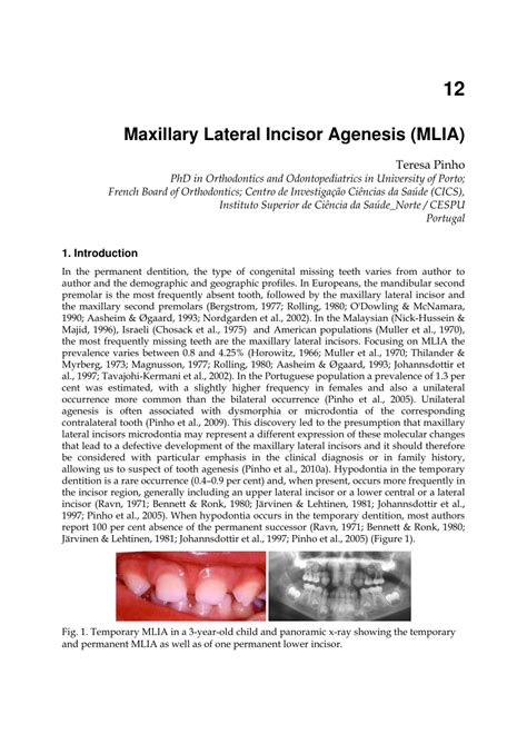 Pdf Maxillary Lateral Incisor Agenesis Mlia