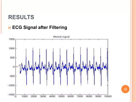 Ecg Beat Classification And Feature Extraction Using Artificial Neural