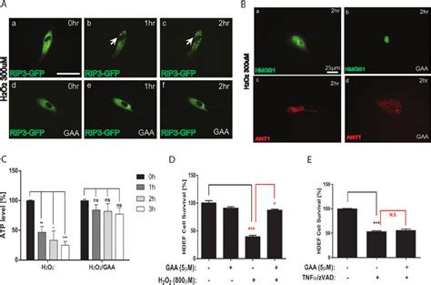 Gaa Inhibits Induction Of Necrosis By Oxidative Stress In Arpe 19