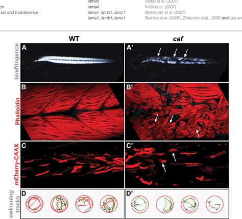 Figure 1 From Zebrafish Models Of Lama2 Related Congenital Muscular
