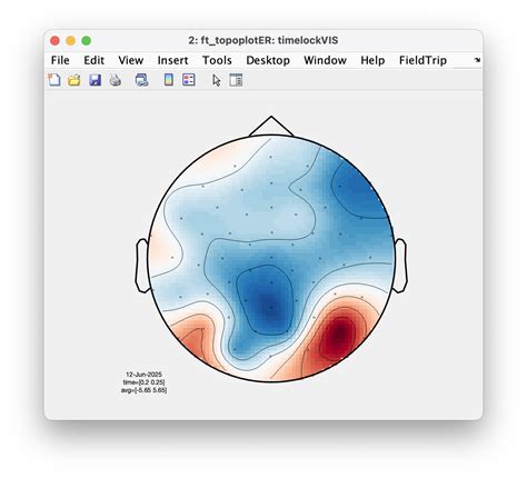 Event Related Potentials Fieldtrip Toolbox
