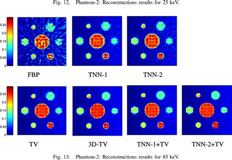 Figure 16 From Tensor Based Formulation And Nuclear Norm Regularization For Multienergy Computed