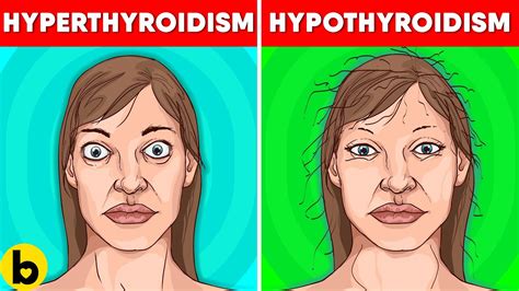 Thyroid Symptoms In Women Drbeckmann