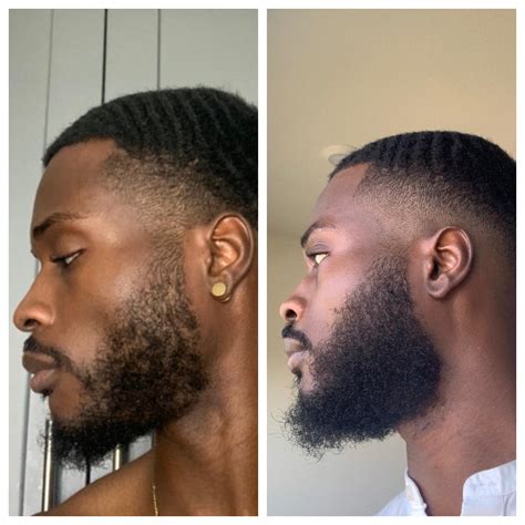 20 Years Old Trying To Grow A Beard 🇳🇱 Rbeards