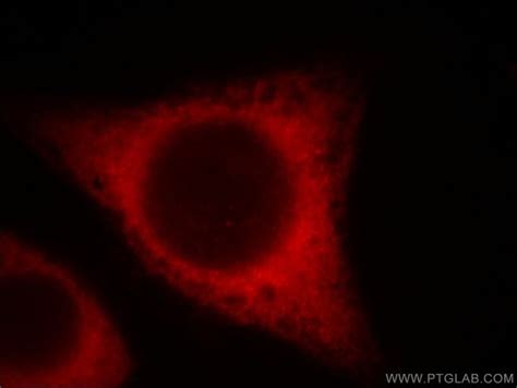 BCS L Mouse anti Human Mouse Clone G H Proteintech μL Unconjugated Antibodies