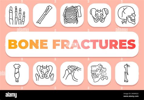 Bone Fractures Text Concept Shablon For Presentation And Infographics Minimal Clean Icons For