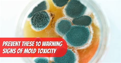 10 Warning Signs Of Mold Toxicity 10 Warning Signs Of Mold Toxicity