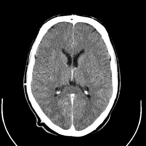 Picasso A Free Open Source Visualizer For Convolutional Neural Networks By Ryan Henderson