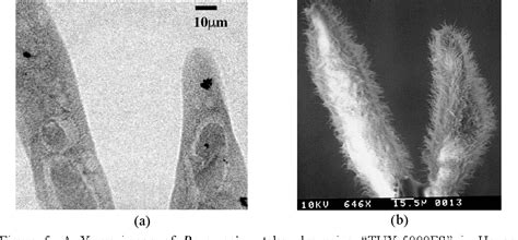 Figure 1 From High Resolution Projection X Ray Microscope Equipped With Fluorescent X Ray