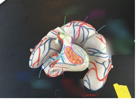 Female Repro Model Lateral Diagram Quizlet