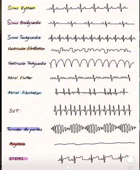 Mohammad Alzyoud On Linkedin Ecg