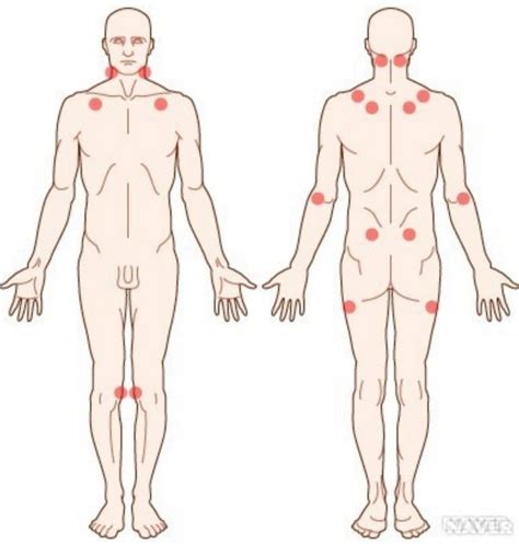 건강정보 건강공부 건강상식 섬유근육통fibromyalgia 👉 근육 관절 인대 힘줄 등 연부조직에 만성적인 통증을 건강을 물어봐 주세요건물주