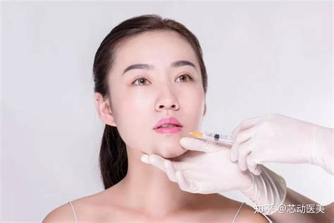 打完玻尿酸当时没事，后来怎么肿了？ 知乎