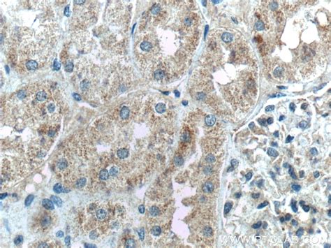 Tslp Antibody 13778 1 Ap Proteintech