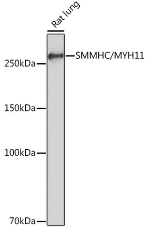 Myh11 Recombinant Monoclonal Antibody 0o4o4 Ma5 42845