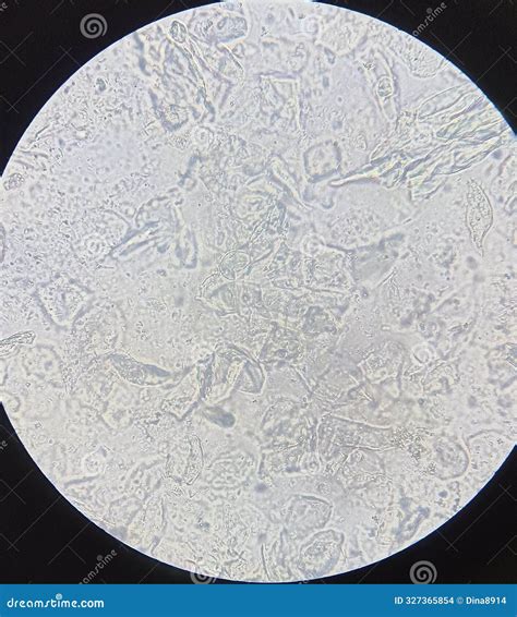 Epithelial Cells In Urine Stock Photo Image Of Human 327365854