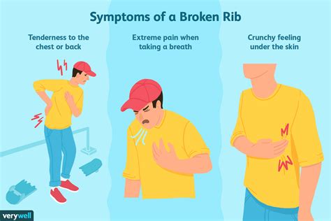 Understanding Rib Fractures Treatment And Recovery