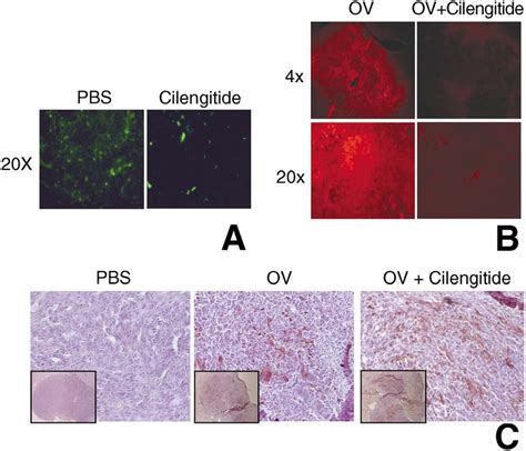 Effect Of Cilengitide Treatment On Angiogenesis In Rat Glioma And