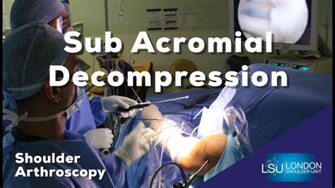 Shoulder Arthroscopy Subacromial Decompression By Consultant Rupen